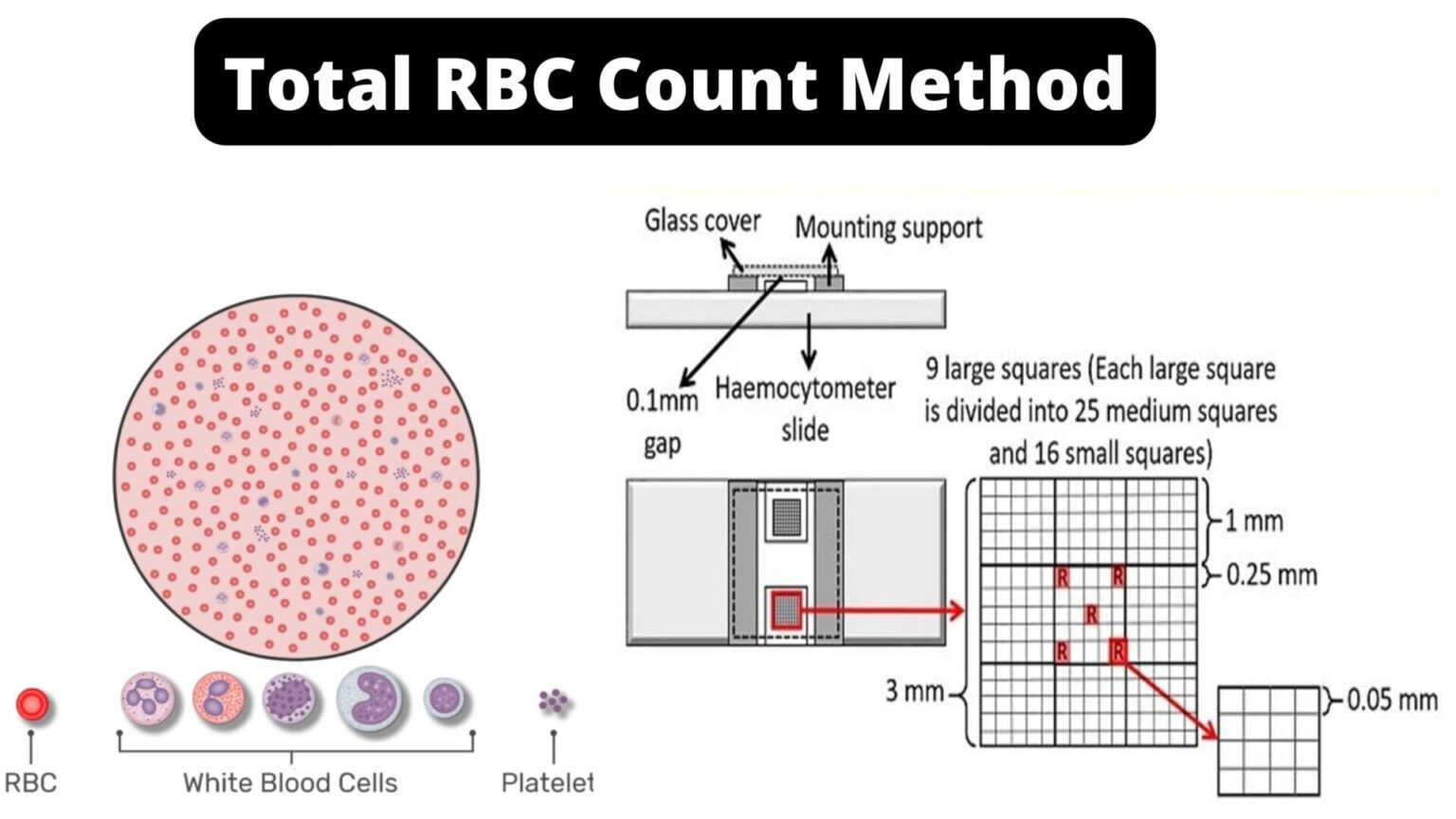 Reticulocyte Count - Principle, Procedure, Calculations and Clinical ...
