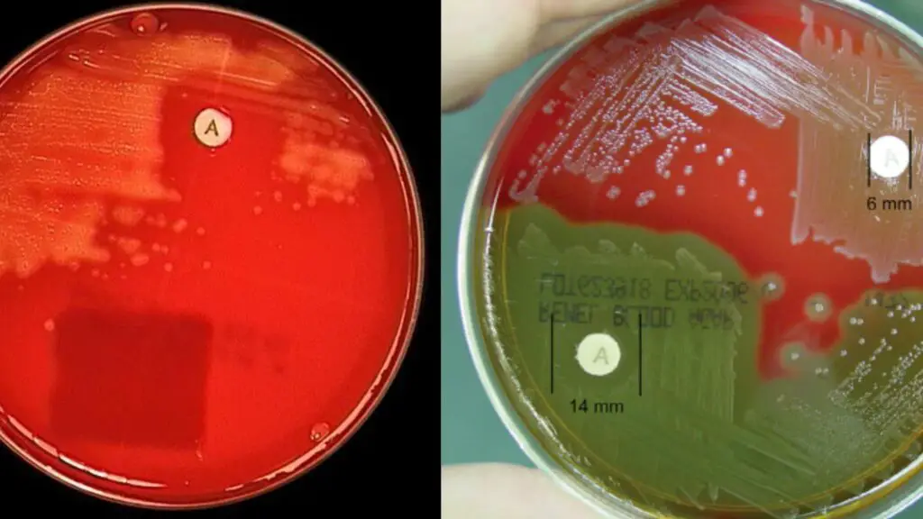 Bacitracin Susceptibility Test - Principle, Procedure, Result - Biology ... Bacitracin Susceptibility Test - Principle, Procedure, Result - Biology ...