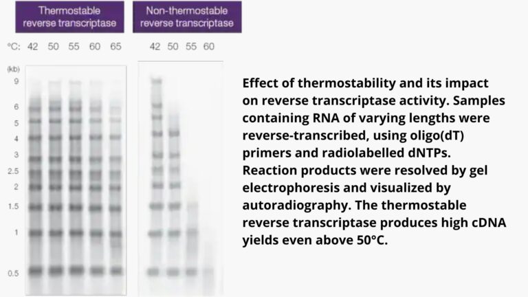 cDNA Synthesis - Principle, Protocol - Biology Notes Online