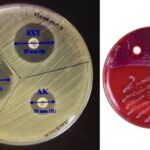 Voges Proskauer (VP) Test - Principle, Procedure, Results - Biology ...