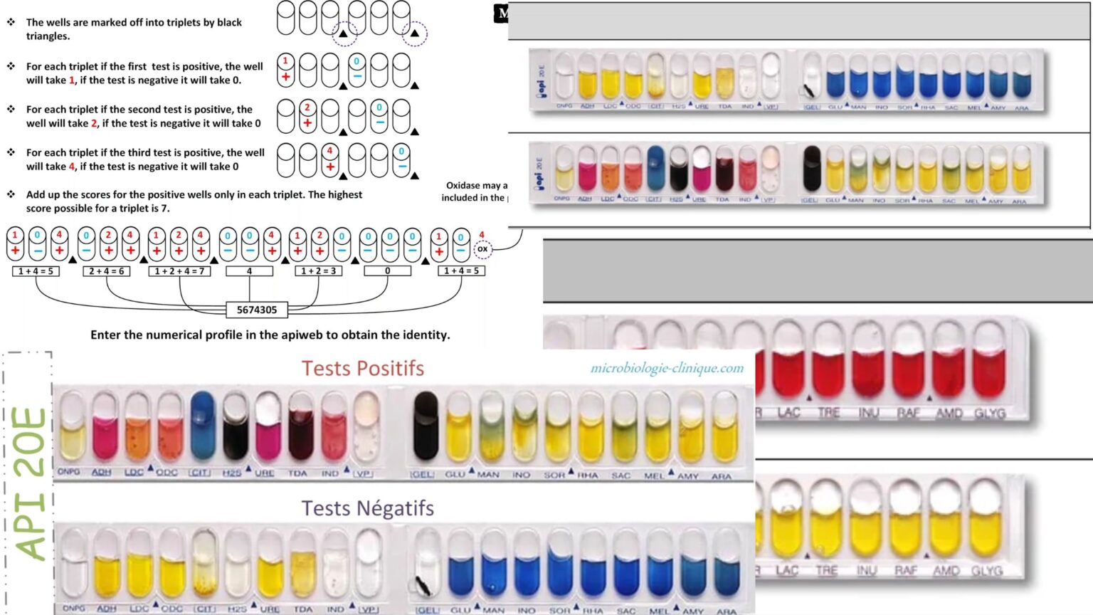 Oxidase Test - Definition, Principle, Procedure, Result, Application ...