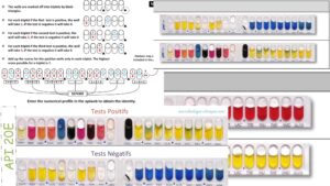 PYR Test (Pyrrolidonyl Arylamidase (PYR) test) - Principle, Procedure ...