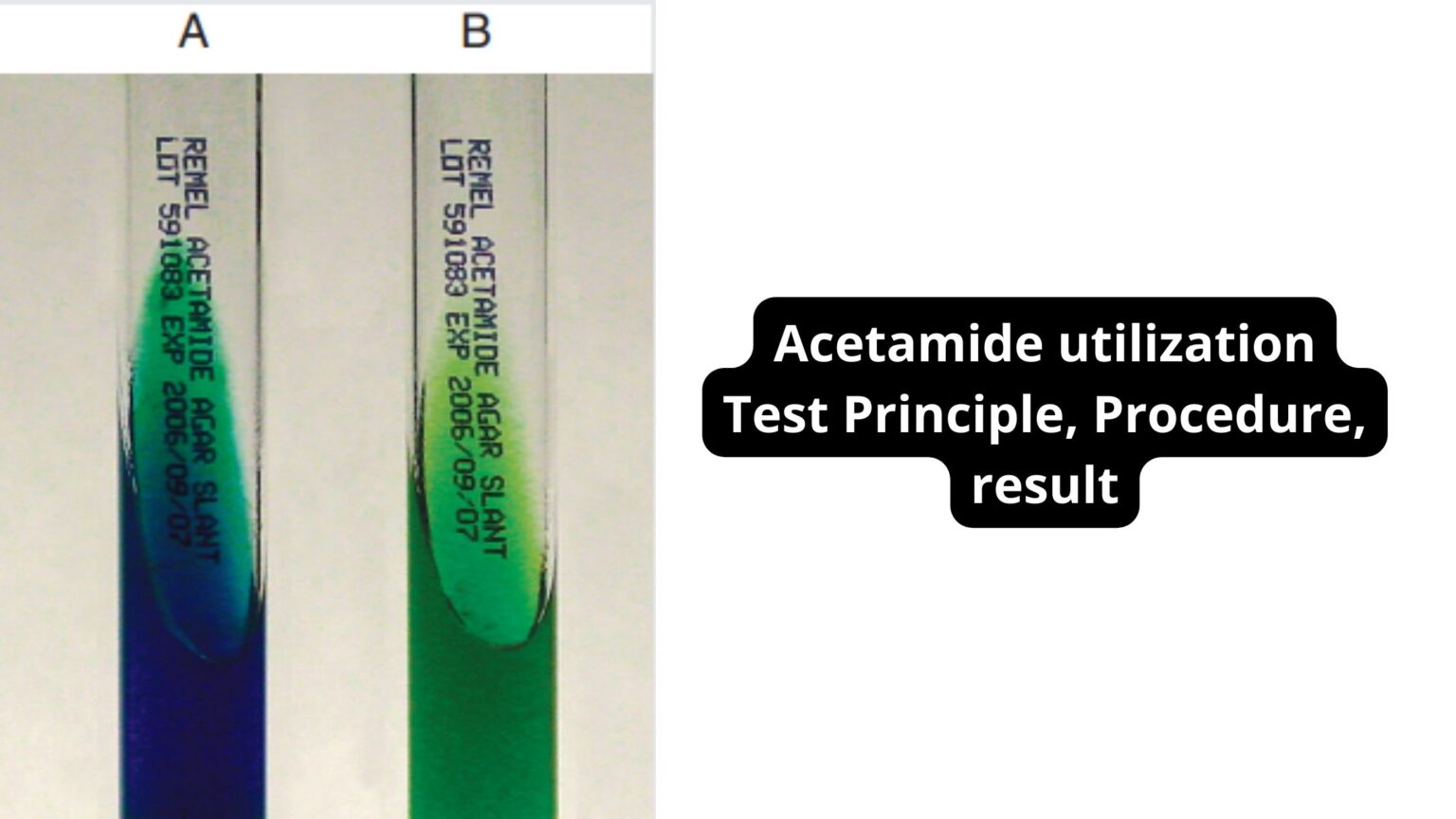 Microdase Test - Principle, Procedure, Result - Biology Notes Online