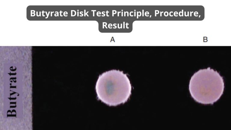 Hippurate Hydrolysis Test - Principle, Procedure, Result - Biology ...