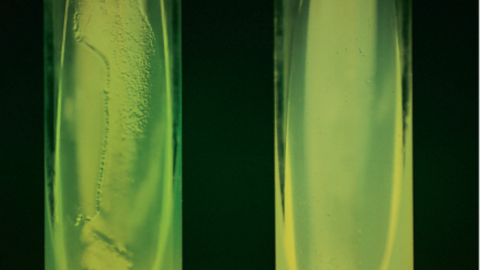 Reverse CAMP test Principle, Procedure, Result - Biology Notes Online