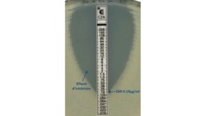 MIC Test Strip - Quantitative assay for determining the Minimum ...