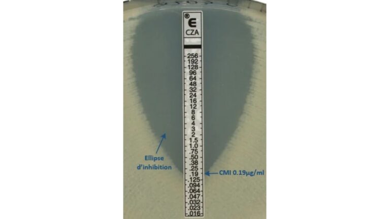 MIC Test Strip - Quantitative assay for determining the Minimum ...