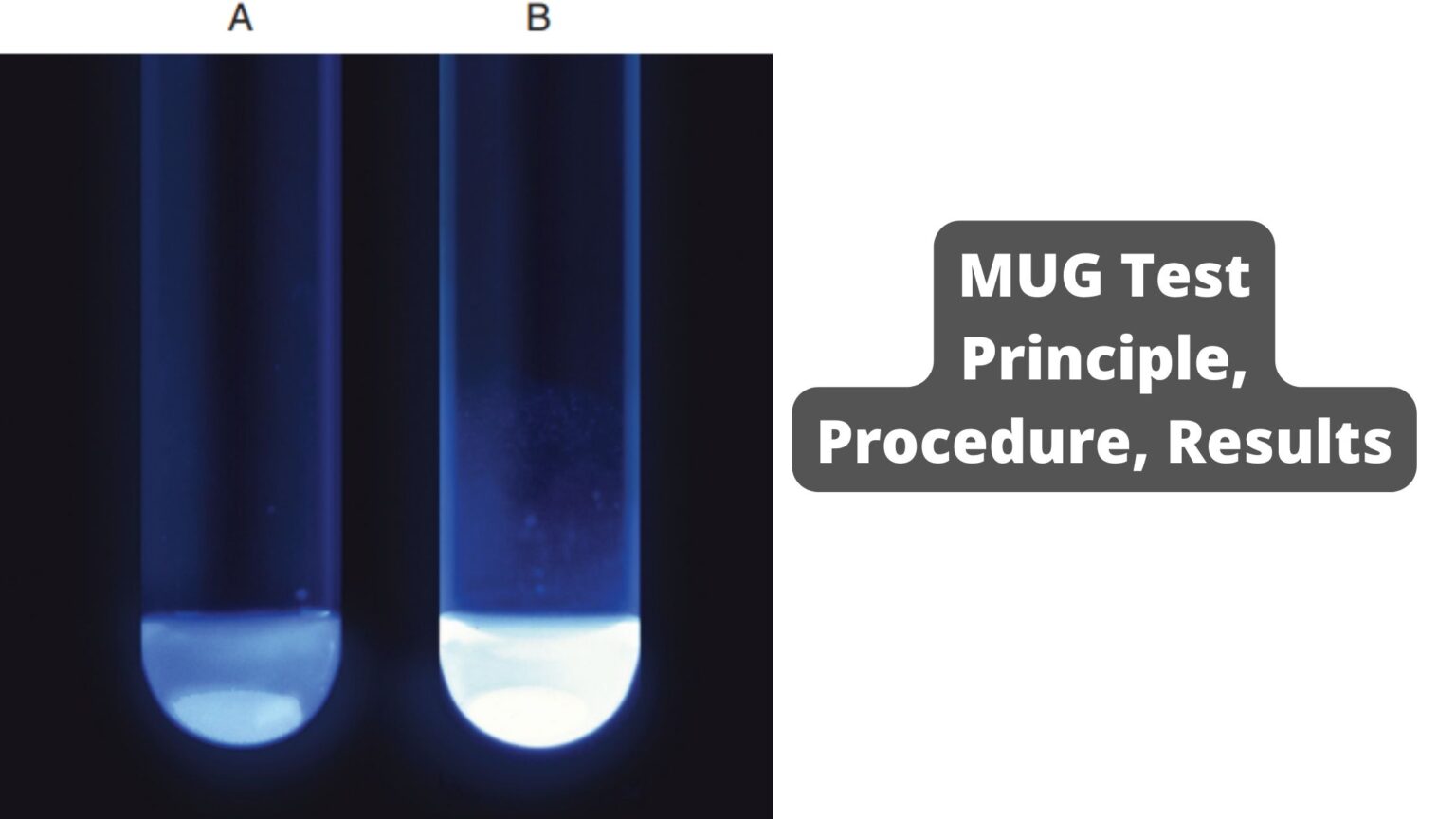 Oxidase Test - Definition, Principle, Procedure, Result, Application ...