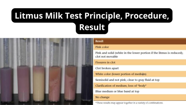 Indole Test - Principle, Procedure, Result, Uses - Biology Notes Online