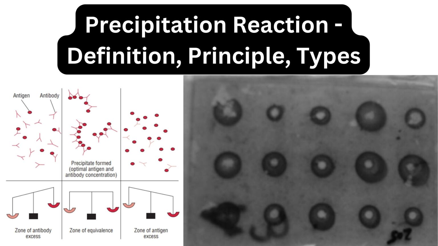 Immunity - Definition, Types, Mechanism, Components, and Immunization ...