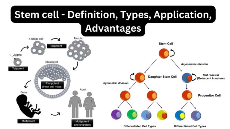 Type III Hypersensitivity - Definition, Types, Mechanism, Examples ...
