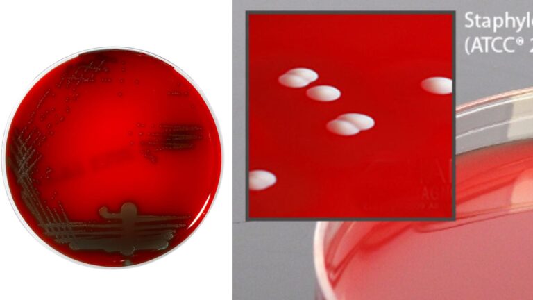 CLED Agar - Composition, Principle, Preparation, Results, Uses ...