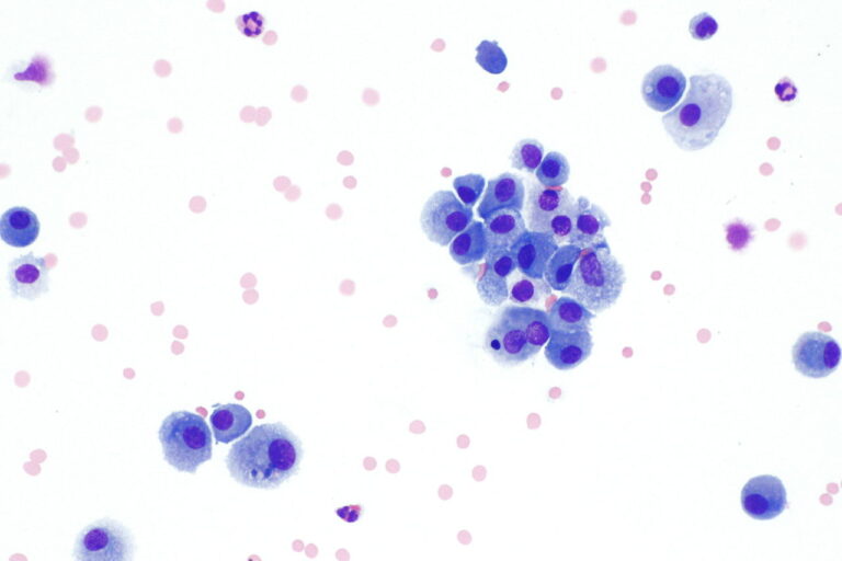 Romanowsky Stains - Principle, Types, Applications - Biology Notes Online