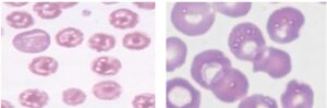 Romanowsky Stains - Principle, Types, Applications - Biology Notes Online
