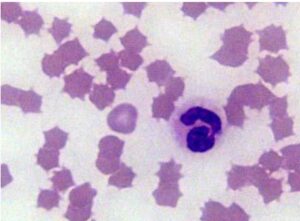 Romanowsky Stains - Principle, Types, Applications - Biology Notes Online