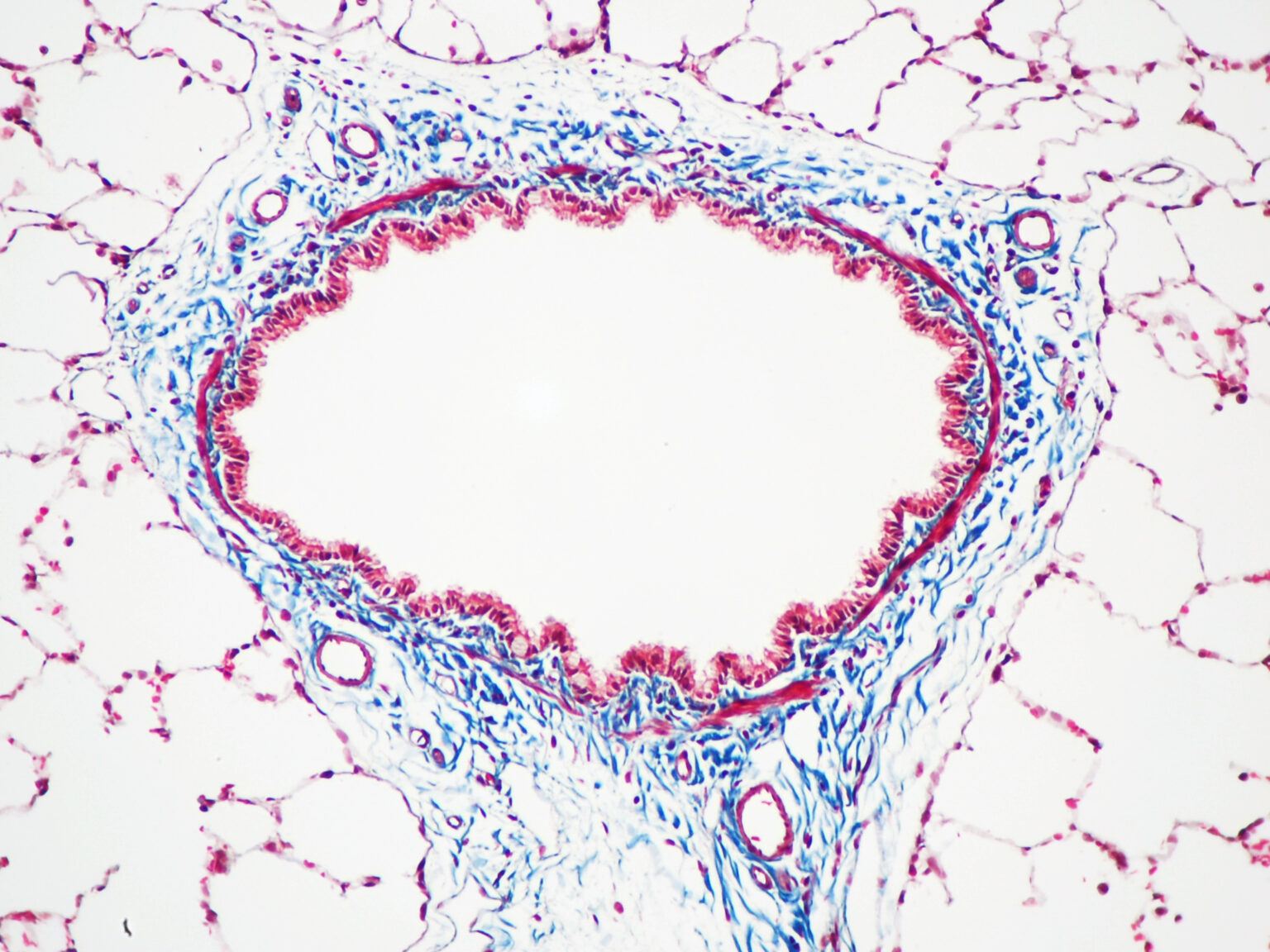 Massons Trichrome Staining Principle Procedure Result Uses Biology Notes Online