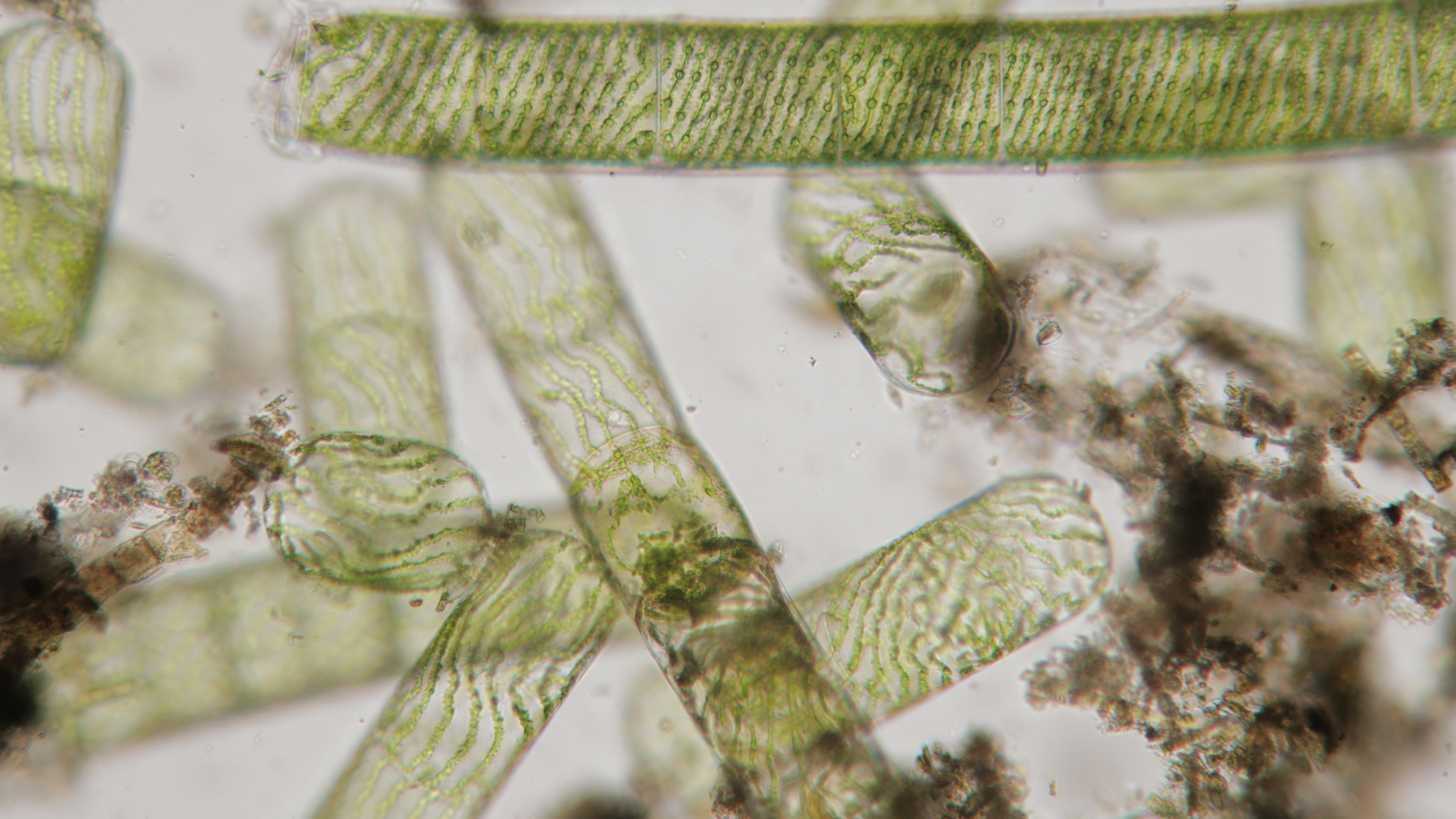 Spirogyra - Definition, Structure, Life Cycle, Diagram, Reproduction ...