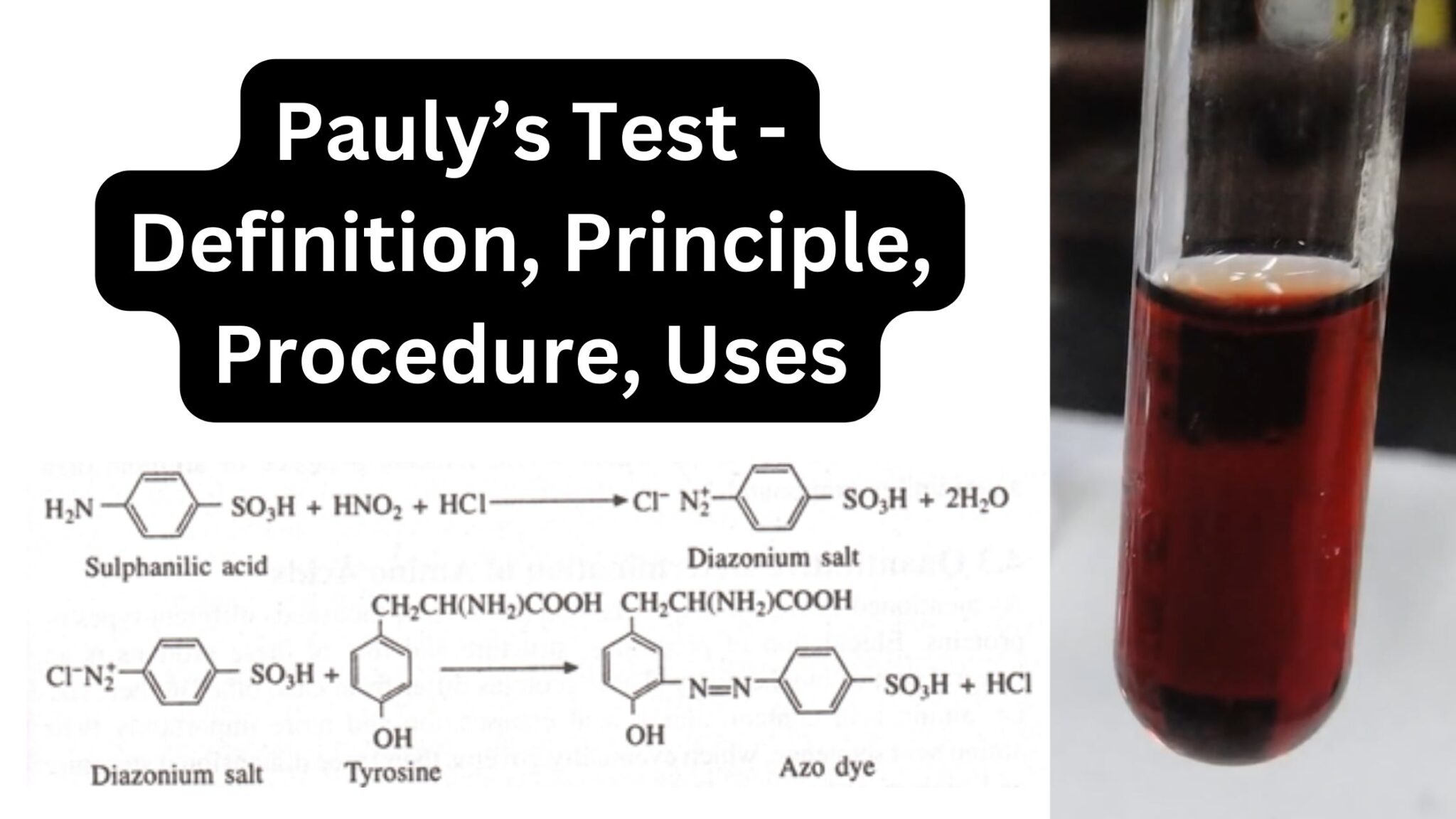 Beta (β) Lactamase Test - Principle, Procedure, Results - Biology Notes ...