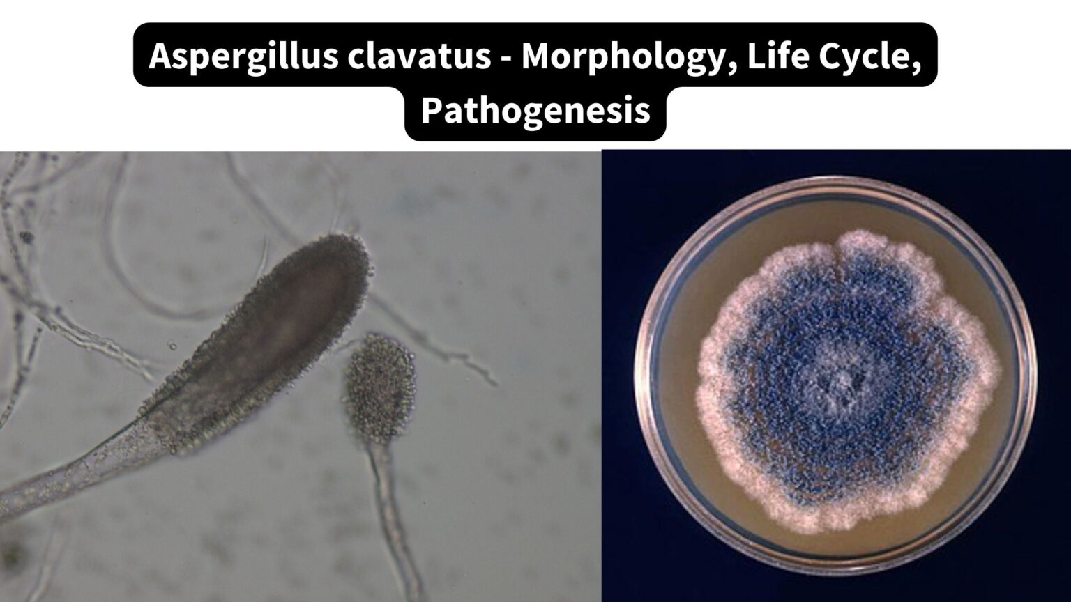 Cryptococcus neoformans - Structure, Infection, Habitat - Biology Notes ...
