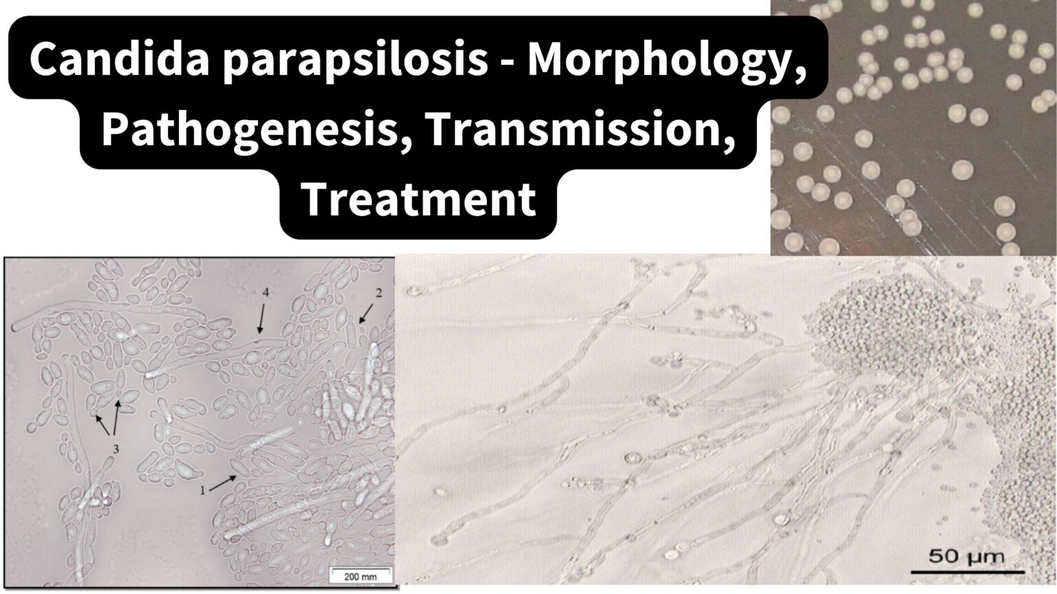 Trichophyton spp - Morphology, Life cycle, Pathogenesis - Biology Notes ...