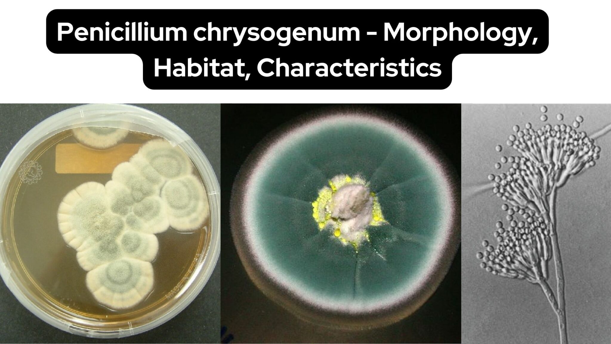 Aspergillus fumigatus - Characteristics, Structure, Pathogenesis ...