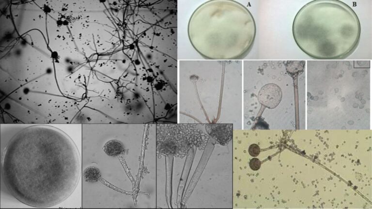 Rhizopus spp - Structure, Life cycle, Habitat, Pathogenesis - Biology ...