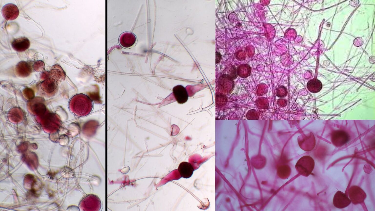 Saprophytes - Definition, Types, Characteristics, Nutritions, Examples ...