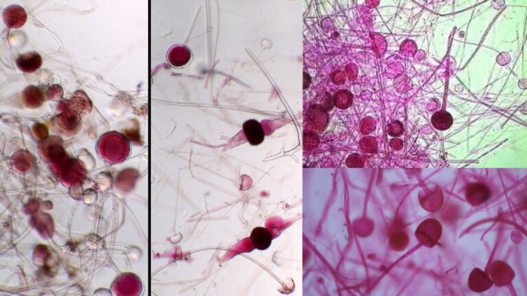Cryptococcus neoformans - Structure, Infection, Habitat - Biology Notes ...