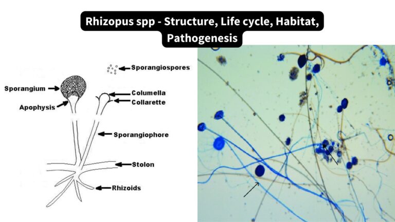 Zygomycosis (Mucormycosis) - Causative Agent, Symptoms, Prevention ...