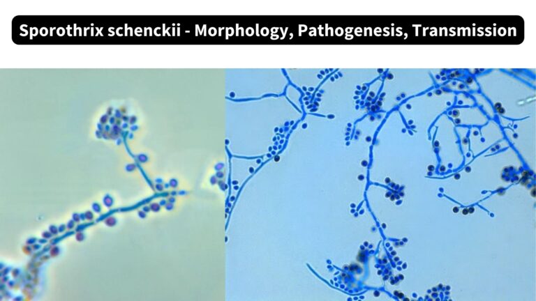 Cryptococcus neoformans - Structure, Infection, Habitat - Biology Notes ...