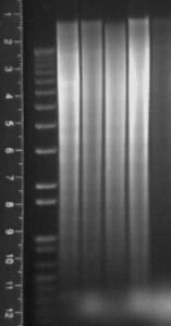 Southern Blot - Definition, Principle, Steps, Importance - Biology ...