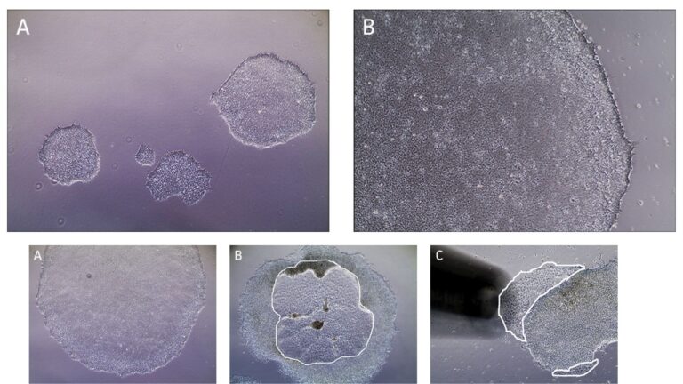 Ageing - Definition, Theories, and models - Biology Notes Online