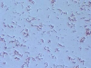 Pseudomonas Aeruginosa Under Microscope (Gram Staining) - Biology Notes ...