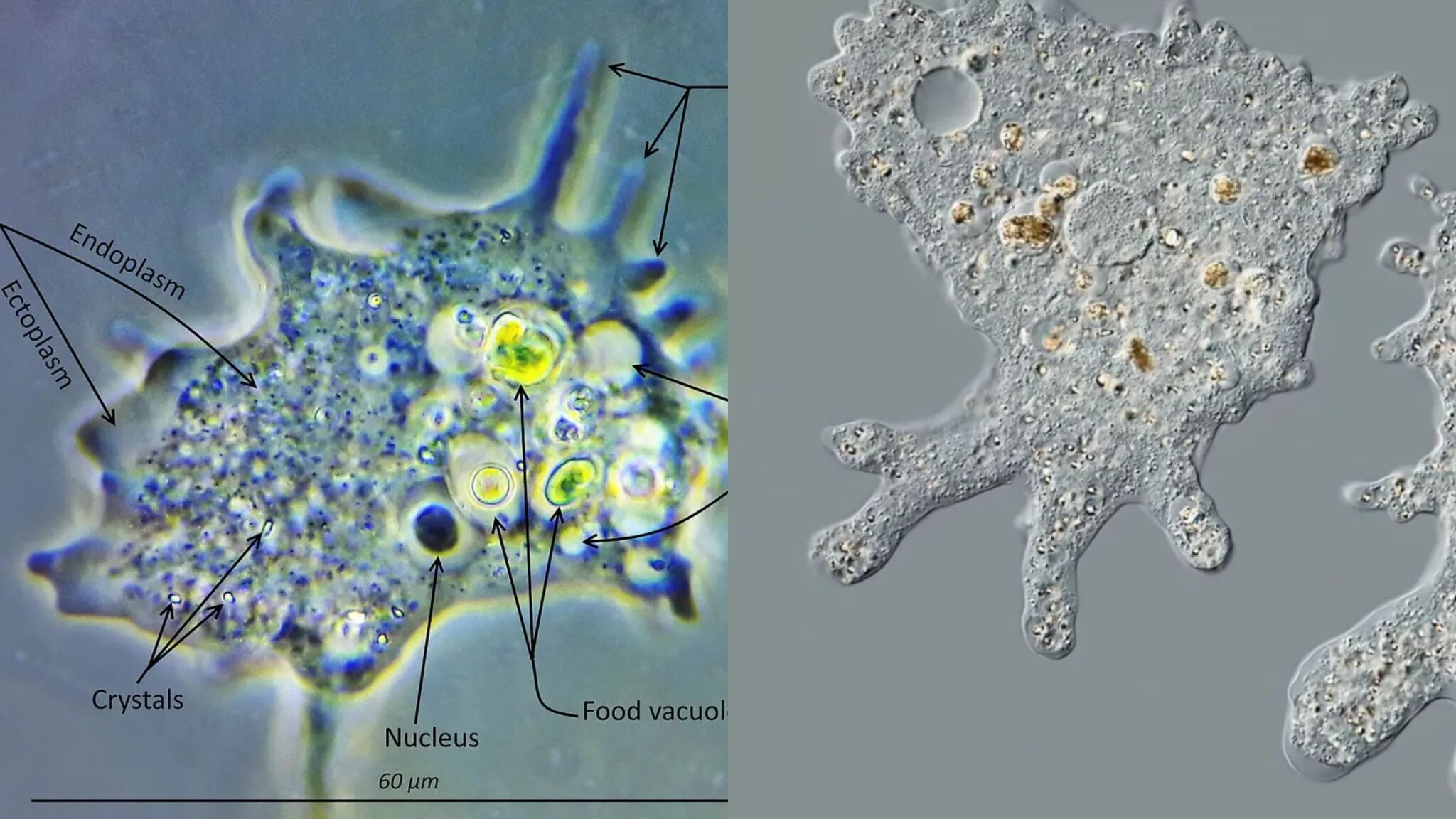 Pseudomonas Aeruginosa Under Microscope (Gram Staining) - Biology Notes ...