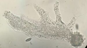Amoeba Under The Microscope - Biology Notes Online