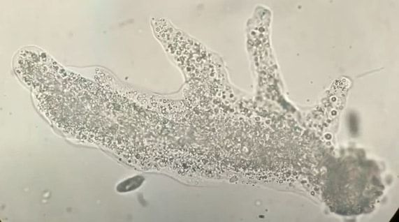 Amoeba Under The Microscope - Biology Notes Online
