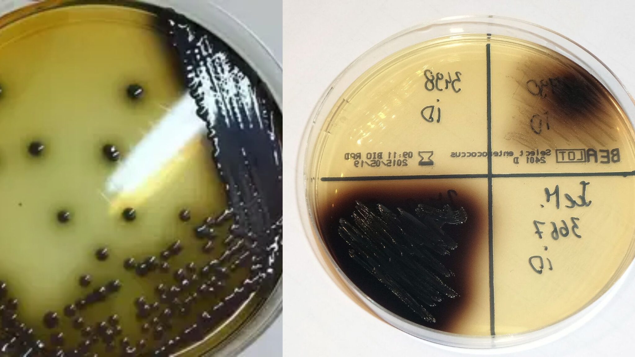 Starch Casein Agar (SCA) - Composition, Principle, Preparation ...