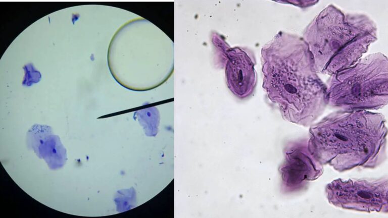 Anabaena Under Microscope - Biology Notes Online