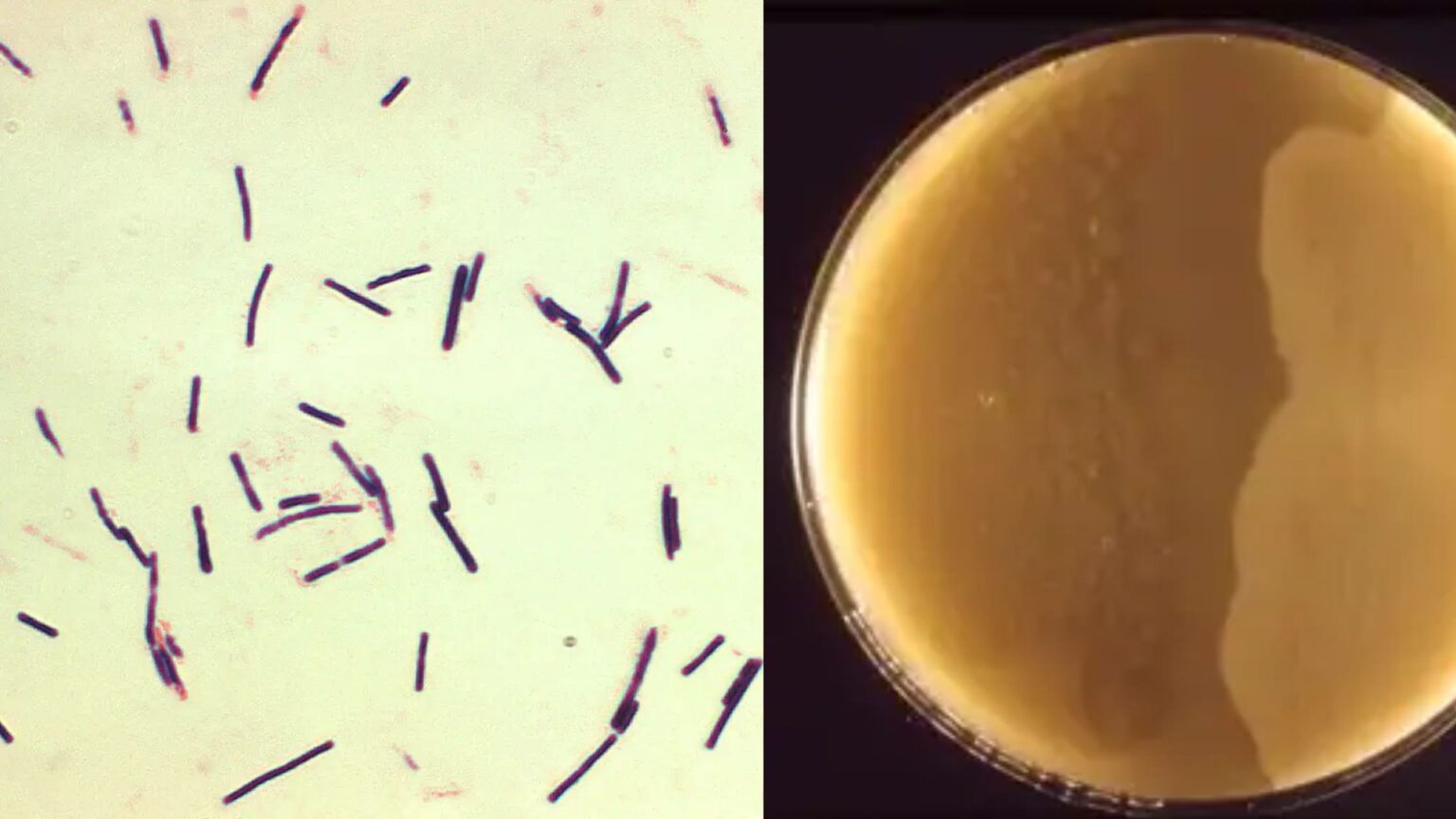 Pseudomonas Aeruginosa Under Microscope (Gram Staining) - Biology Notes ...