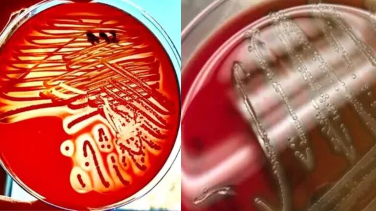 Tryptic Soy Agar (TSA) - Composition, Principle, Preparation, Results ...