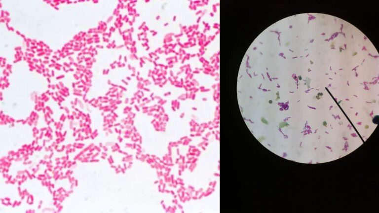 Trichomes Under Microscope - Biology Notes Online