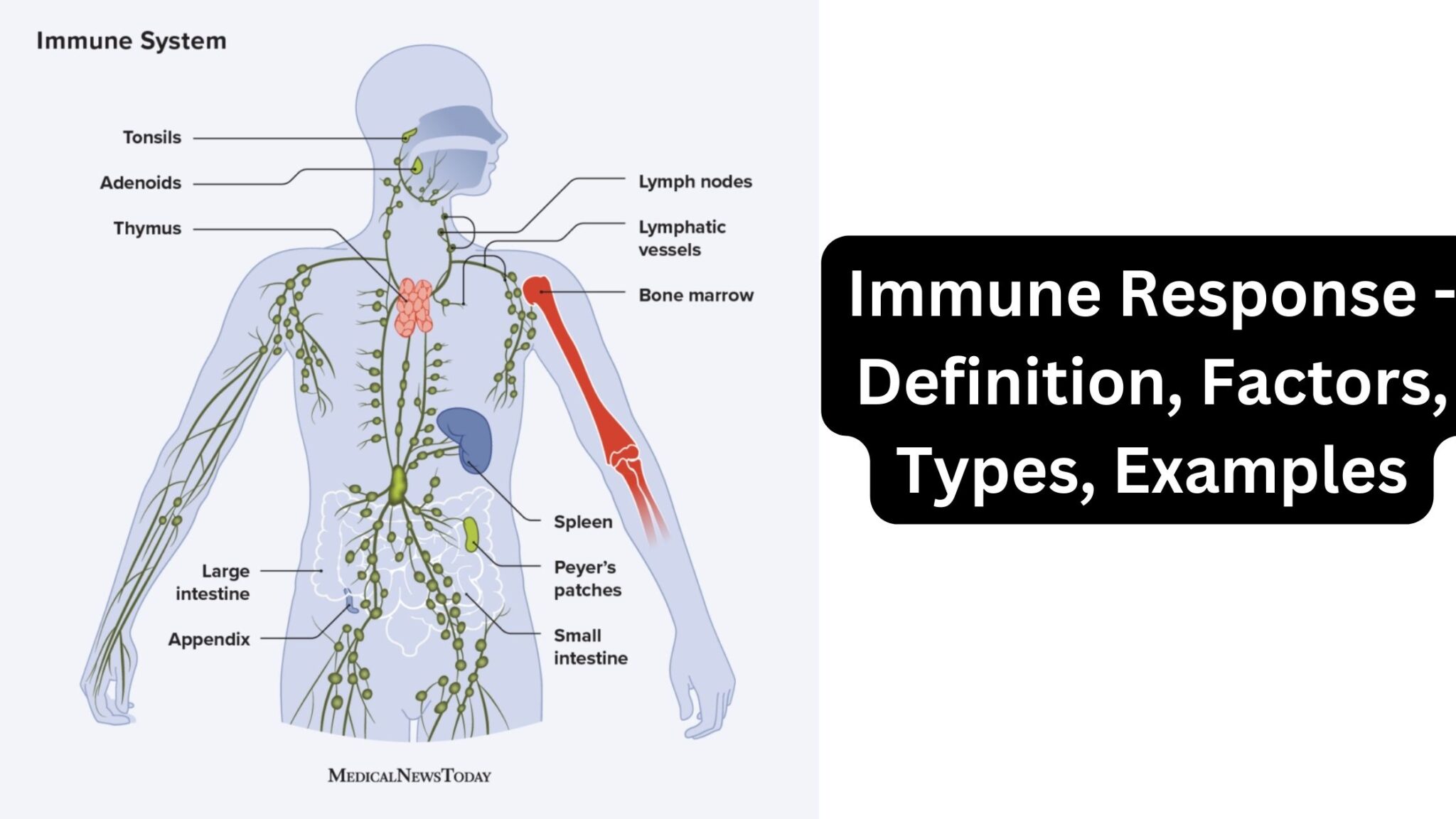 Type II (Cytotoxic) Hypersensitivity - Definition, Mechanism, Examples ...