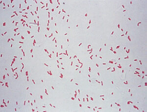 Pseudomonas Aeruginosa Under Microscope (Gram Staining) - Biology Notes ...