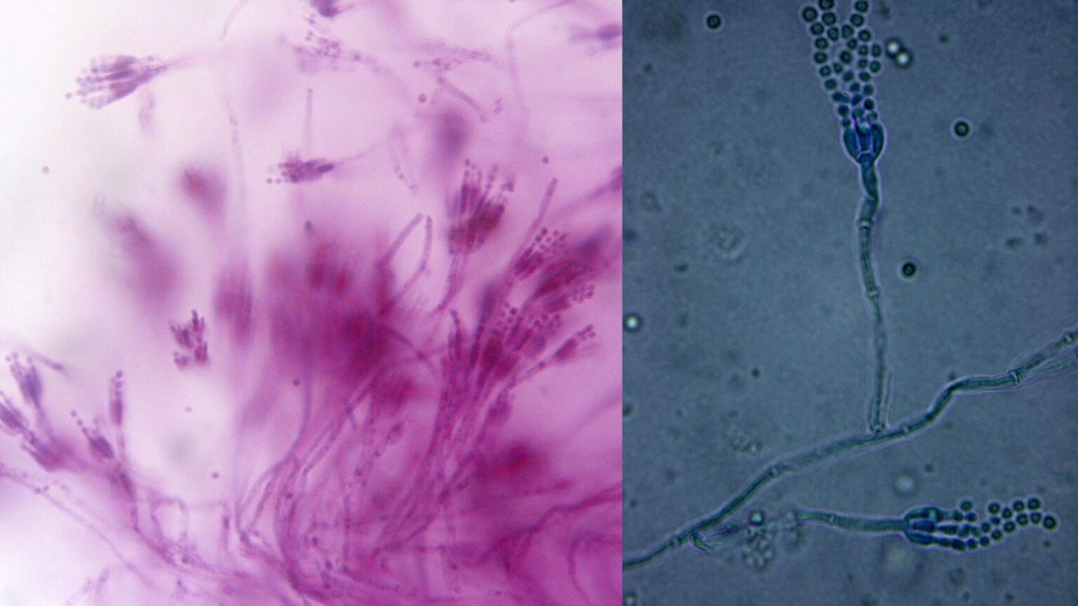 Trichonympha Under Microscope - Biology Notes Online