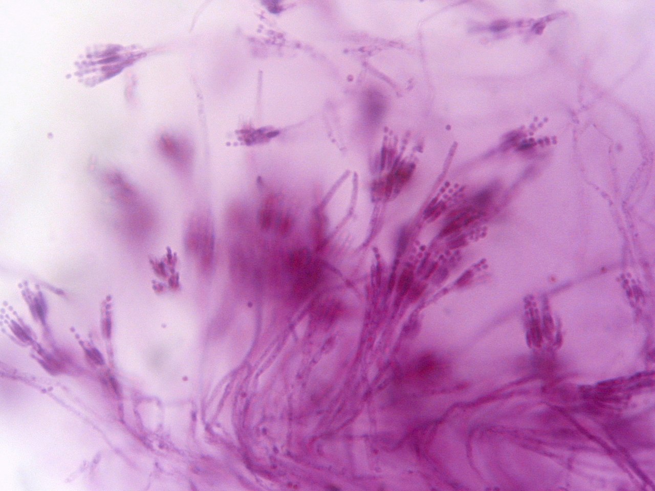 Penicillin Under a Microscope - Biology Notes Online