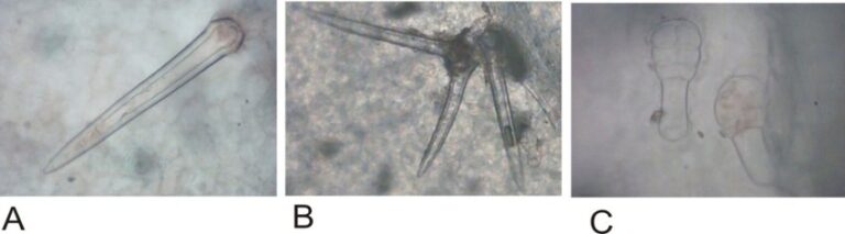Chlamydia Under the Microscope - Biology Notes Online