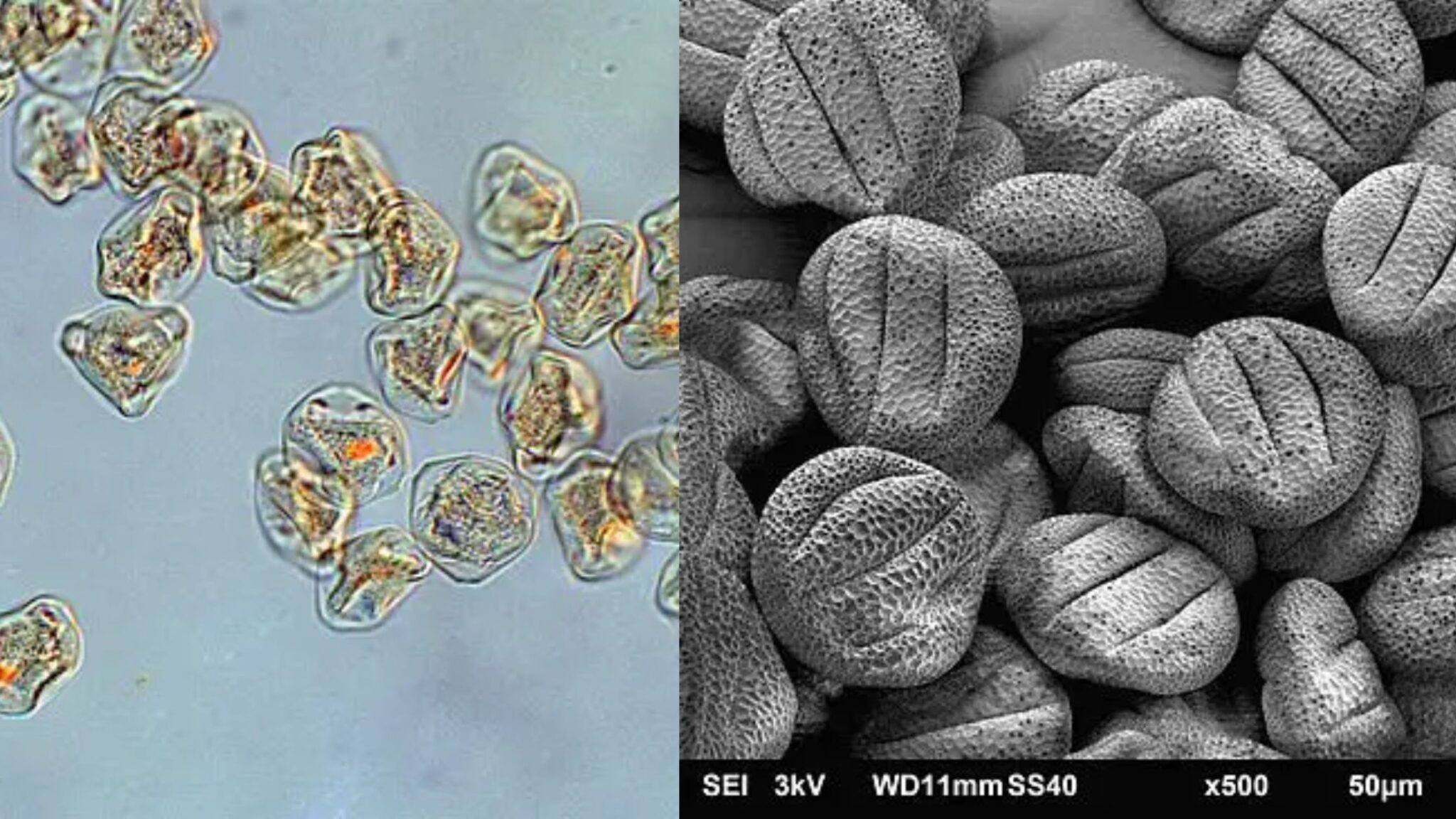 Euglena Under The Microscope - Biology Notes Online