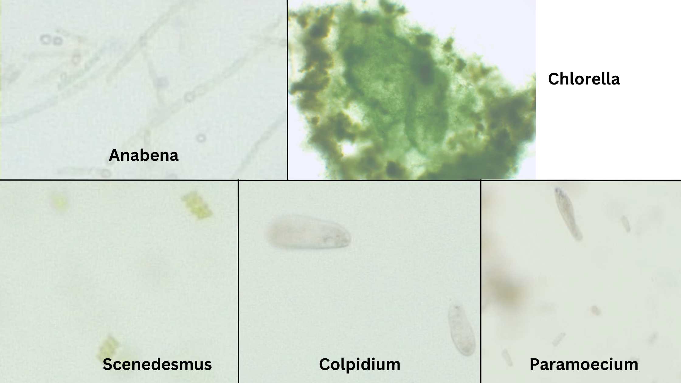 Green Algae In Ponds Under Microscopes Euglena Protozoa In Pond Water