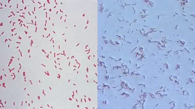 Penicillin Under a Microscope - Biology Notes Online