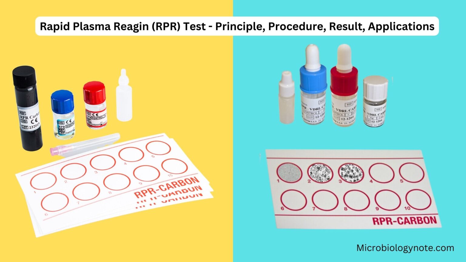 Radioimmunoassay (RIA) Test - Definition, Principle, Procedure, Results ...